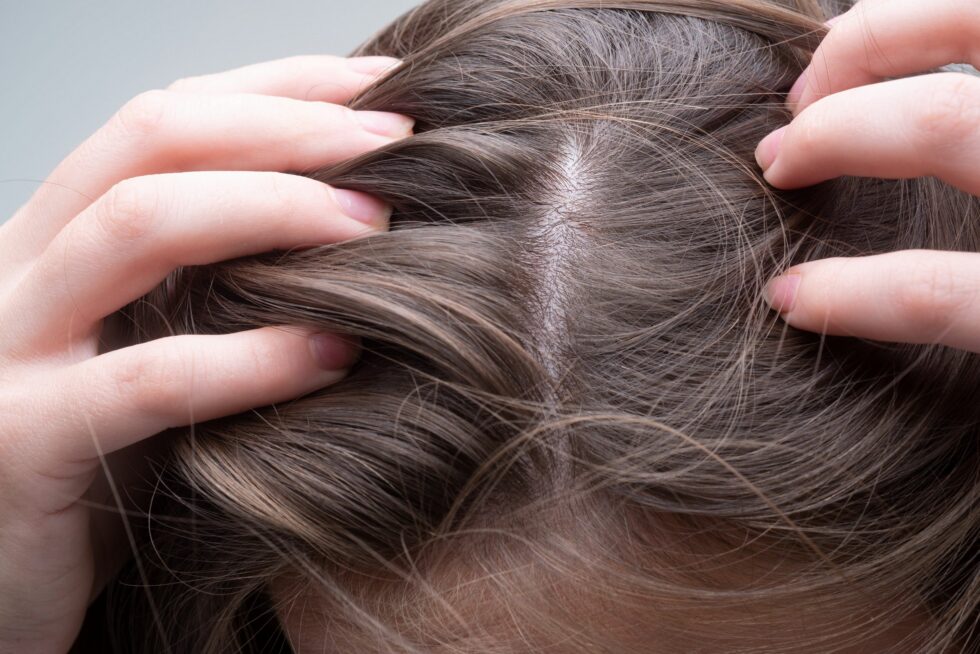 La beauté de vos cheveux commence par un cuir chevelu sain - Therapie ...
